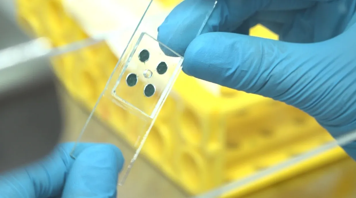 LAB ON A CHIP – xét nghiệm nhanh chỉ bằng 1 con chip