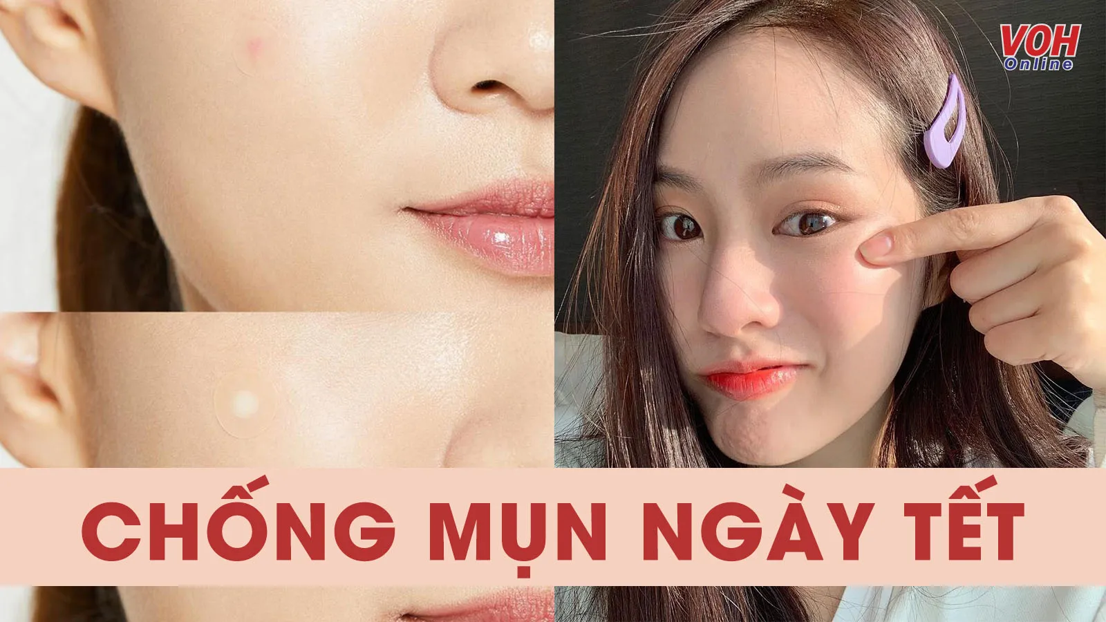 3 nên 4 không nên cần ghi nhớ để không bị nổi mụn ngày Tết