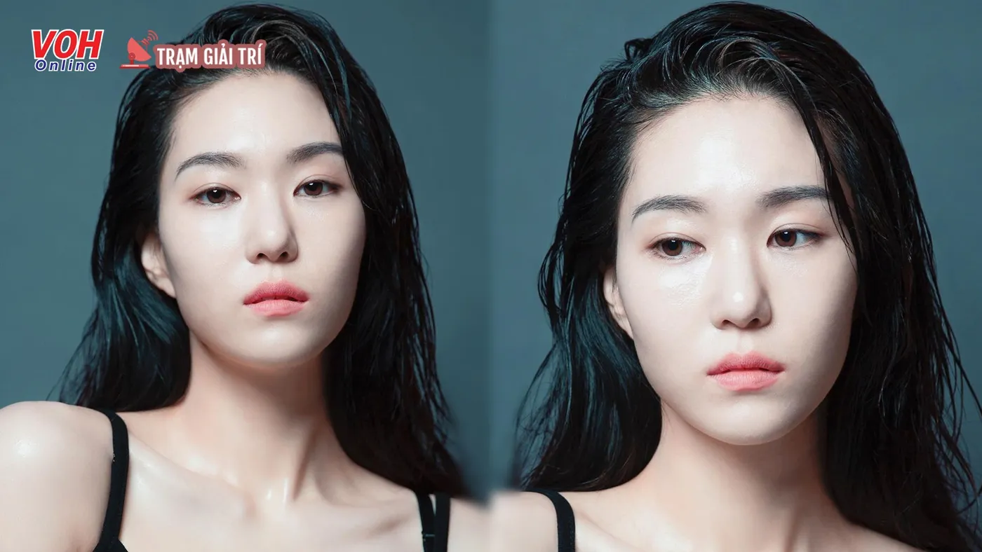 Nữ diễn viên Go Ah Sung bị gãy xương, phải nhập viện 3 tháng